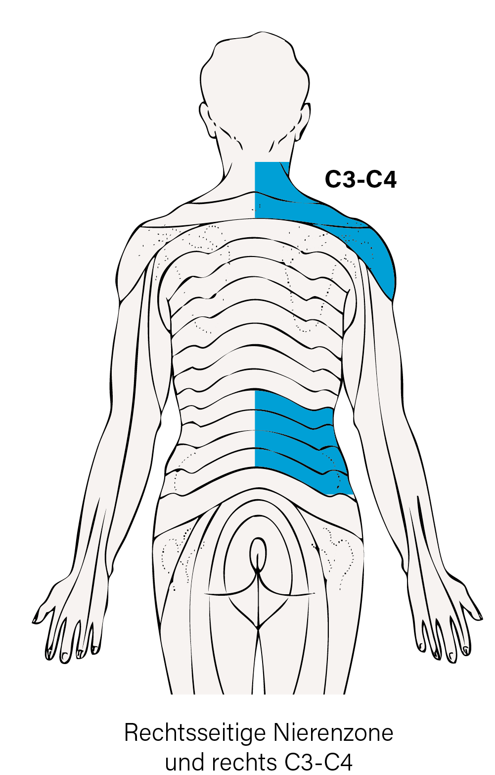 Schulterschmerzen aus Sicht der APM nach Radloff